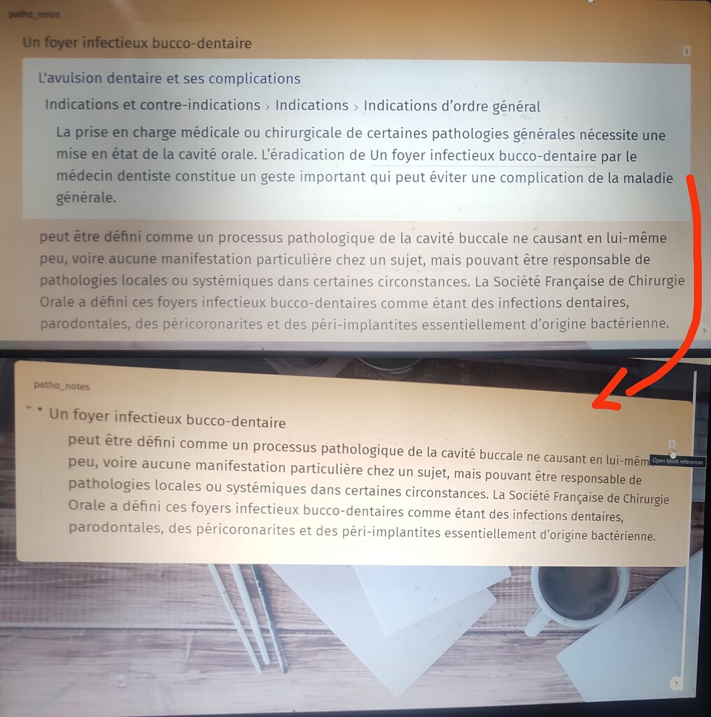 Auto-collapse block references - Questions & Help - Logseq